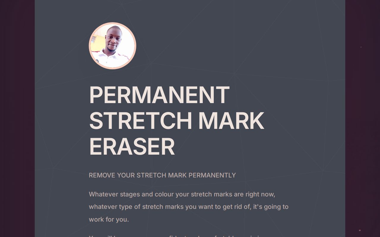 Stretch Mark Removal